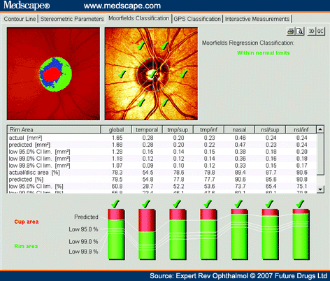 Advances in Ocular Imaging - Page 5