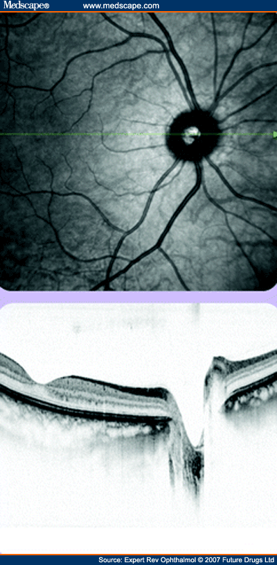 Advances in Ocular Imaging - Page 8