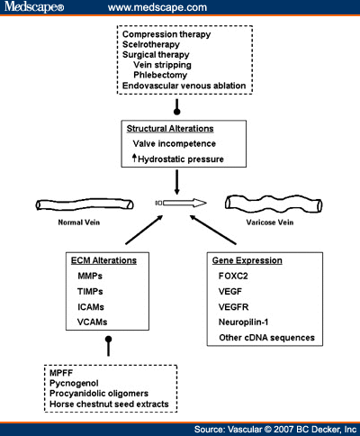 Pathogenesis of Varicose Veins and Implications for Clinical Management ...