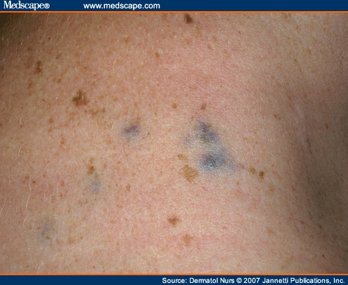 What's Your Assessment?