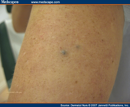 What's Your Assessment?