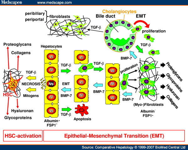 Evolving Concepts of Liver Fibrogenesis