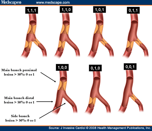 Bifurcation CAD: Current Techniques and Future Directions