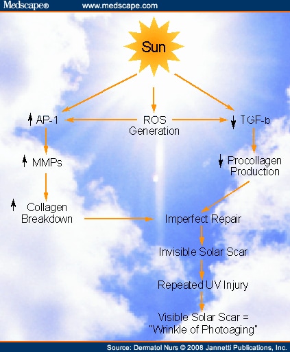 Overview of Skin Aging and Photoaging - Page 4