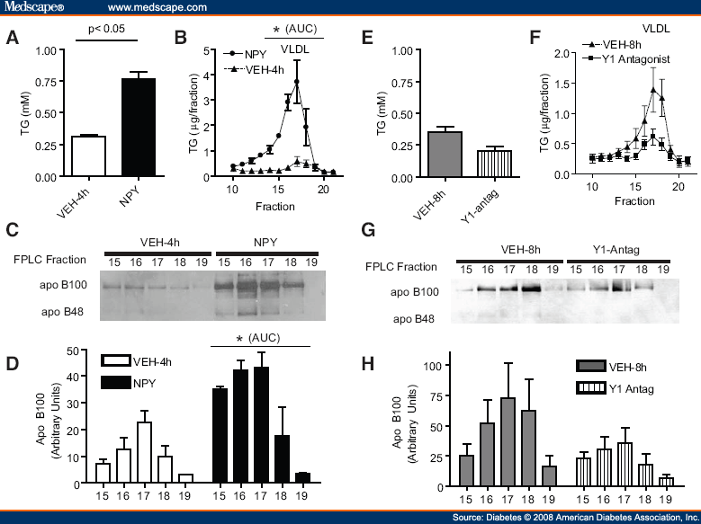 CNS Neuropeptide Y Signaling Modulates VLDL Triglyceride Secretion - Page 3