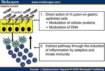 Mechanism for Gastric Cancer Development by Helicobacter pylori ...