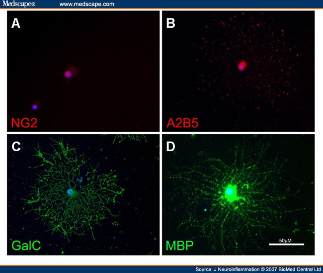 Stage of Oligodendrocytes Determines Response to Microglia In Vitro ...