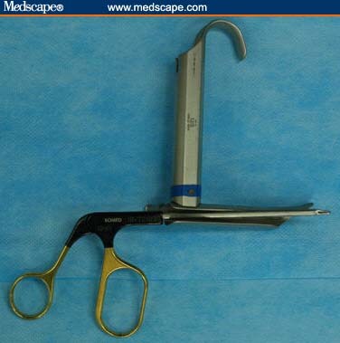 Supraglottoplasty in Infants Using Sinus Instruments