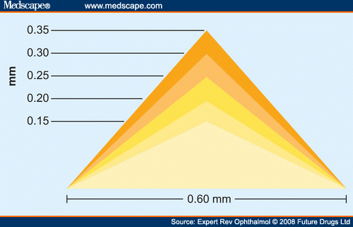 Intracorneal Ring Segments for Keratoconus - Page 2