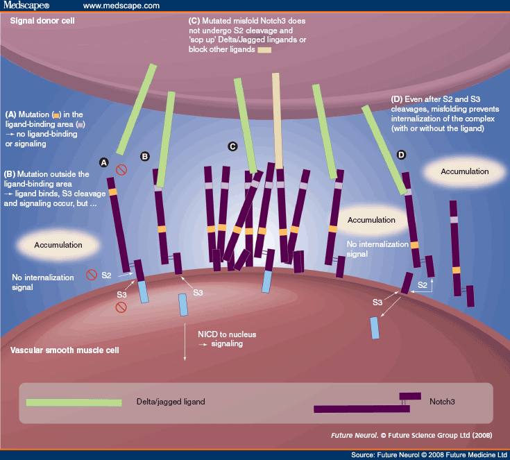 CADASIL: The Most Common Hereditary Subcortical Vascular Dementia - Page 9