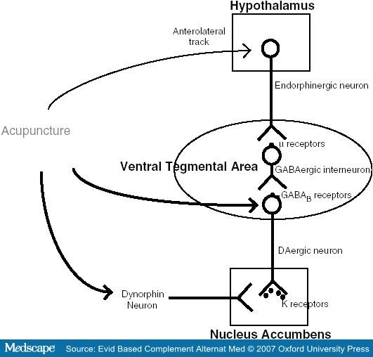 The Effectiveness of Acupuncture in the Treatment of Drug Addiction ...