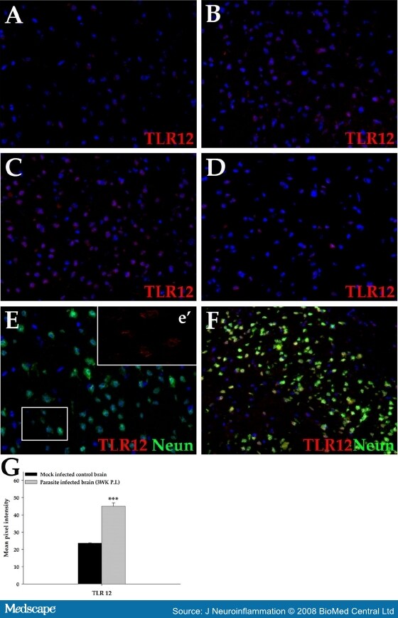 Toll-Like Receptors 11-13 in the Brain During Murine Neurocysticercosis ...
