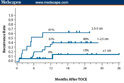 Advanced Hepatocellular Carcinoma