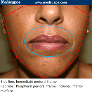 An Executive Who Wants to Look Her Best on Her Wedding Day