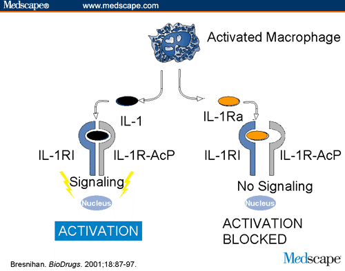 Managing Rheumatoid Arthritis: A Case of Diminishing Treatment Effect