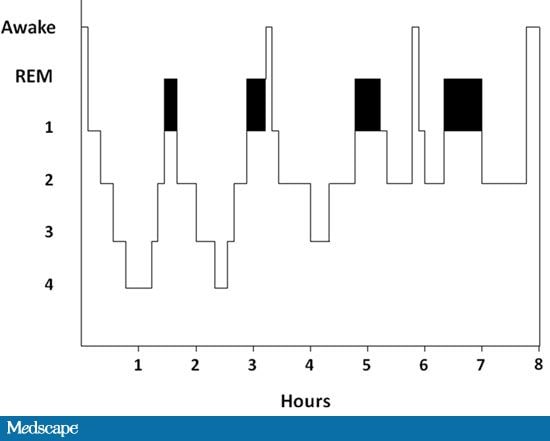 Pathophysiology and Slow Wave Sleep