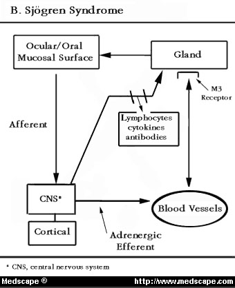 Sjögren Syndrome: New Approaches to Treatment