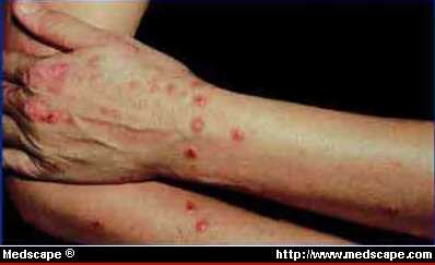 Primary Care Dermatology Roundtable: Common Dermatologic Conditions...