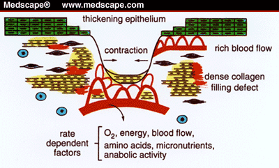 Protein-Energy Malnutrition, and the Nonhealing Cutaneous Wound