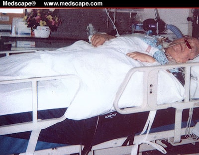 Effect of a Catabolic State With Involuntary Weight Loss on Acute and ...