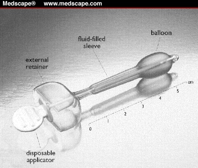New Insight Into Urinary Stress Incontinence: Advice for the Primary ...