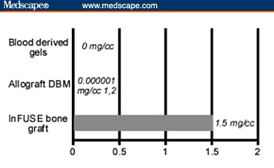 New Bone Graft Techniques and Applications in the Spine
