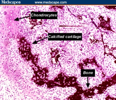 New Bone Graft Techniques and Applications in the Spine