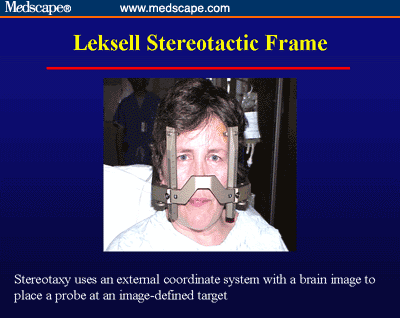 Deep Brain Stimulation for Parkinson's Disease: An Update