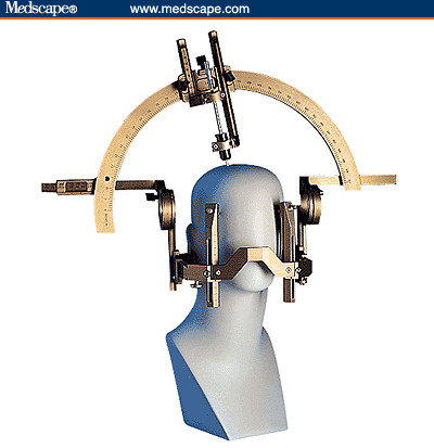 Deep Brain Stimulation for Parkinson's Disease: An Update
