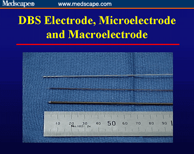 Deep Brain Stimulation for Parkinson's Disease: An Update