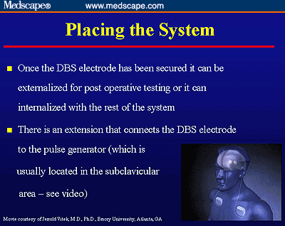 Deep Brain Stimulation for Parkinson's Disease: An Update