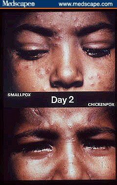 Syndrome-Based Surveillance for Clinicians on the Frontlines of ...