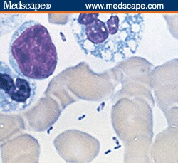 Medscape Personal Professor: Plague