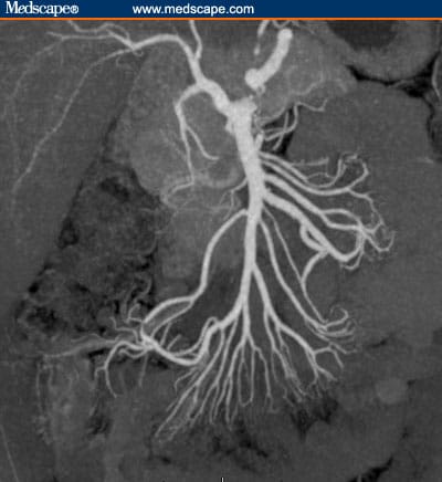 Computed Tomography of the Abdomen and Pelvis: A Guide for Referring ...