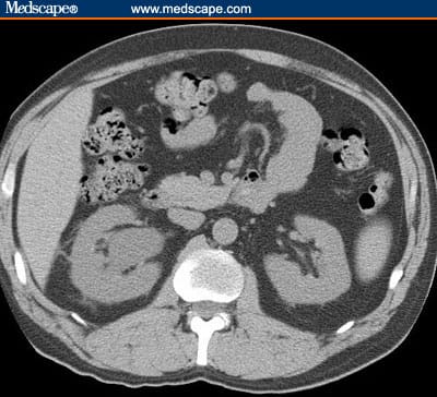 Computed Tomography of the Abdomen and Pelvis: A Guide for Referring ...