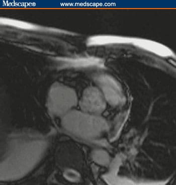Cardiac MRI: Ready for Prime Time? Case Review and Commentary