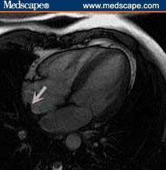 Cardiac MRI: Ready for Prime Time? Case Review and Commentary