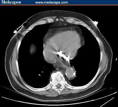 Cardiac MRI: Ready for Prime Time? Case Review and Commentary