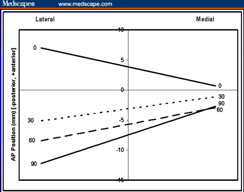 Rotating-Platform Total Knee Arthroplasty