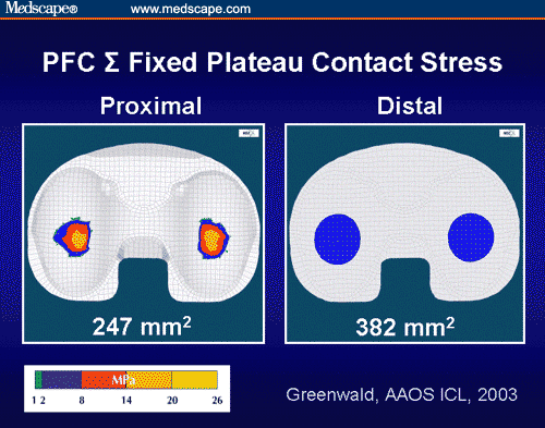 Rotating-Platform Total Knee Arthroplasty