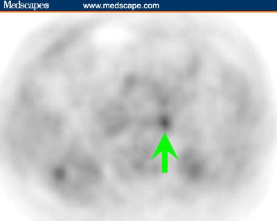 The Place for PET: The Online Handbook for Referring Physicians and Imagers