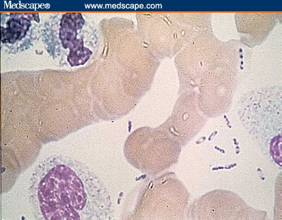 Terrorism and Disaster - What Clinicians Need to Know: Pneumonic Plague