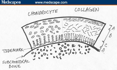 Curing Cartilage Injuries Part 1: New Diagnostic and Surgical Solutions