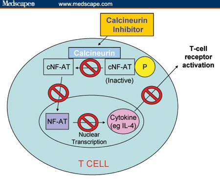 Treatment of Atopic Dermatitis: Optimizing Management and Implications ...