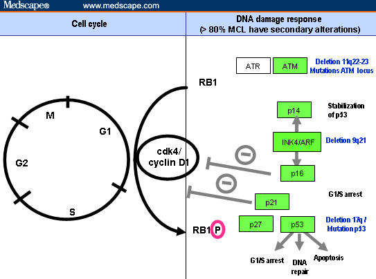 Mantle Cell Lymphoma