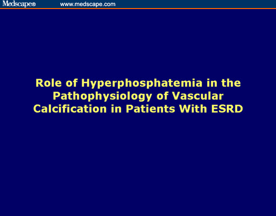 Cardiovascular Calcification Due to Hemodialysis Treatment in ESRD Patients