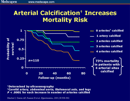 Cardiovascular Calcification Due to Hemodialysis Treatment in ESRD Patients