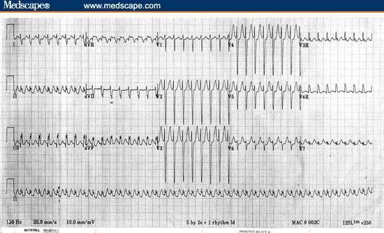 Neonatal Emergencies