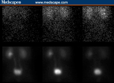 Clinical Applications of Tc-99m MAG3 Renography