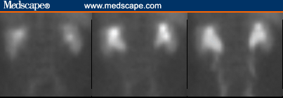 Clinical Applications of Tc-99m MAG3 Renography